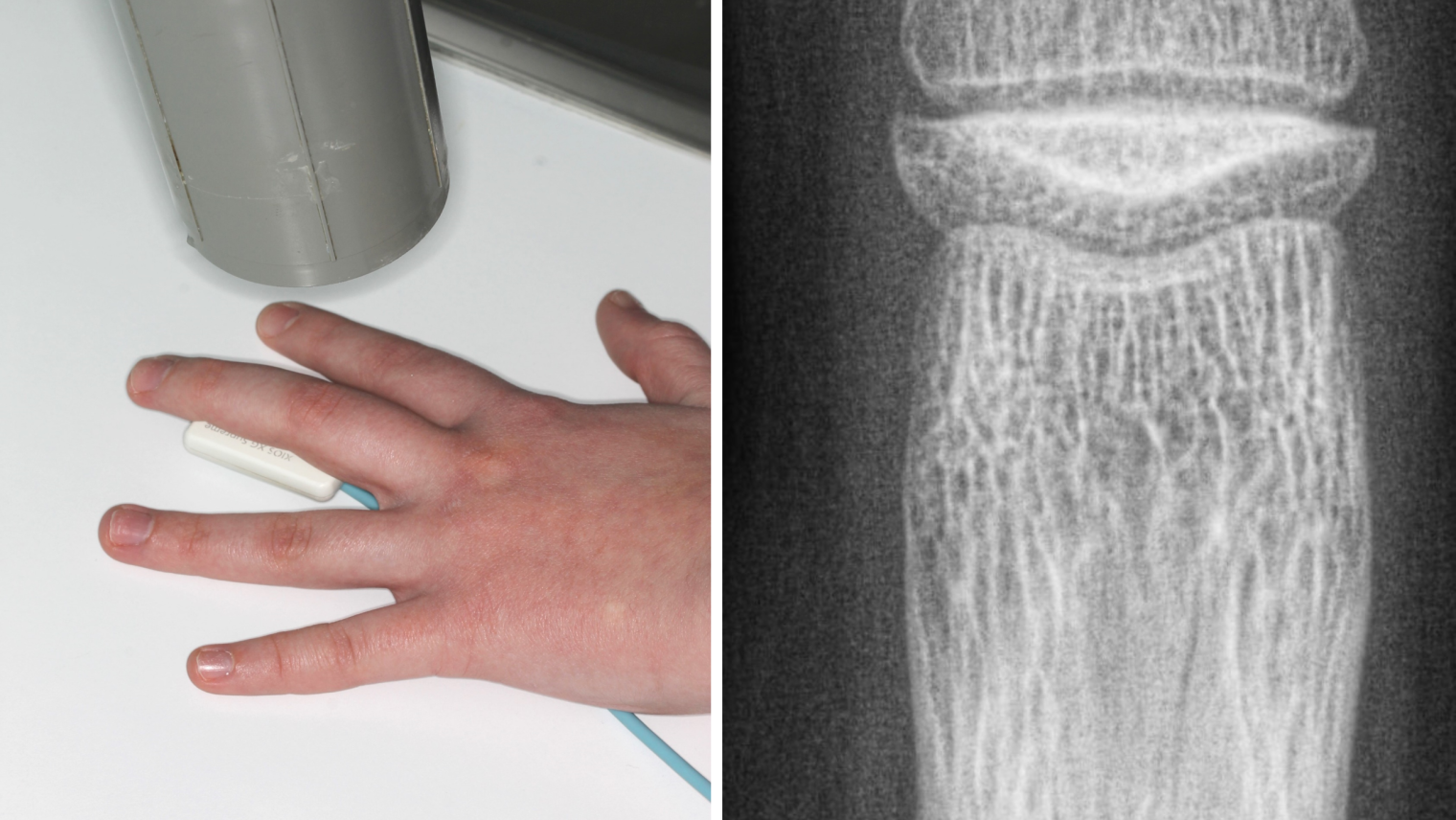 Rendgensko snimanje u ortodonciji – sve što trebate znati – Ortho M